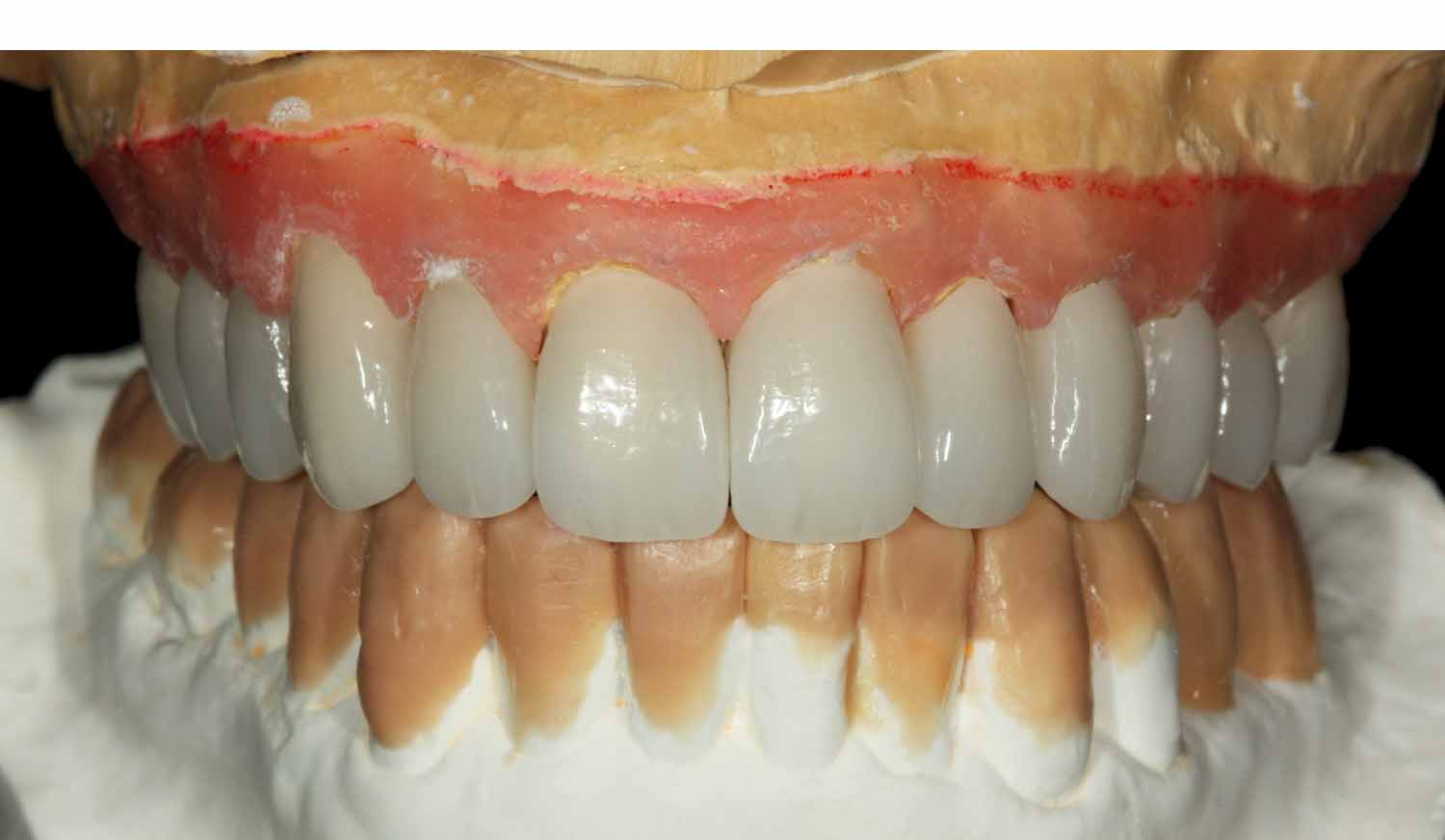 fullmod - Crystal Dental Design